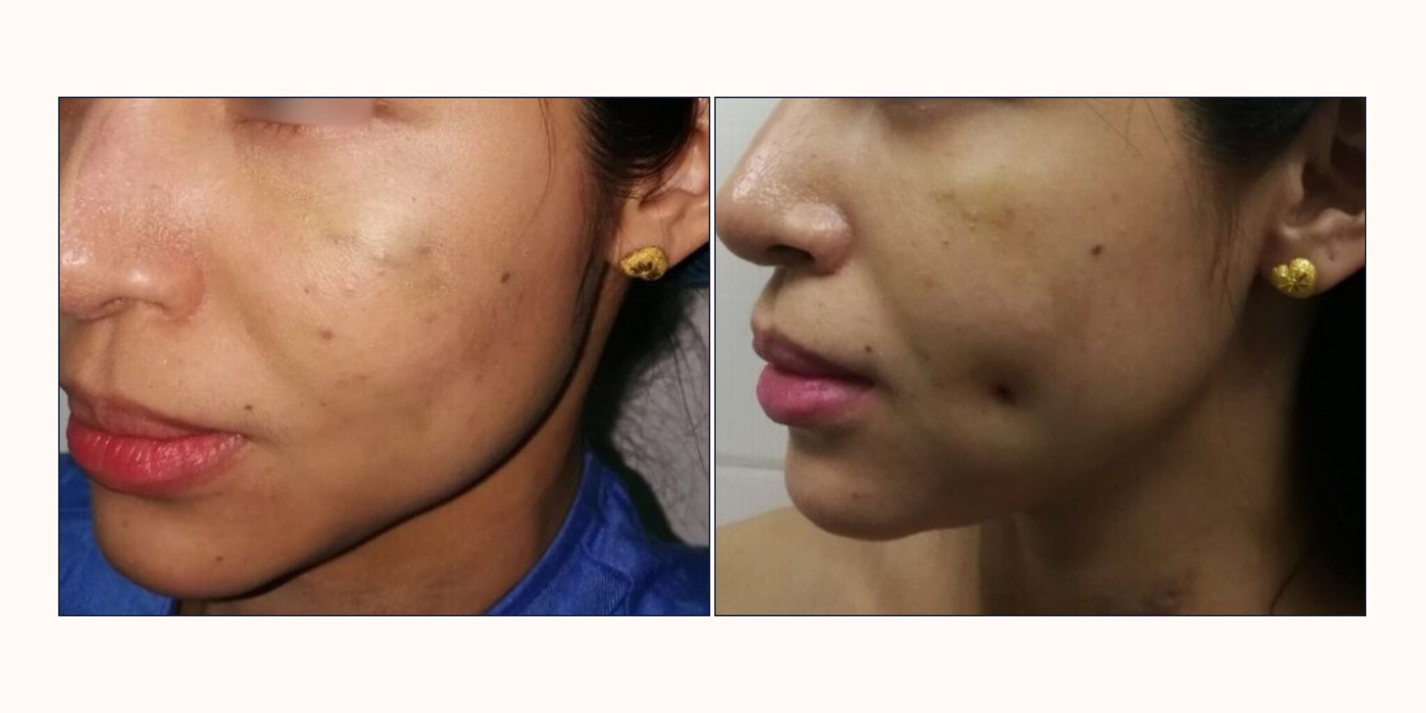 Cosmetic Surgery | Manny and Pie Calayan Clinic